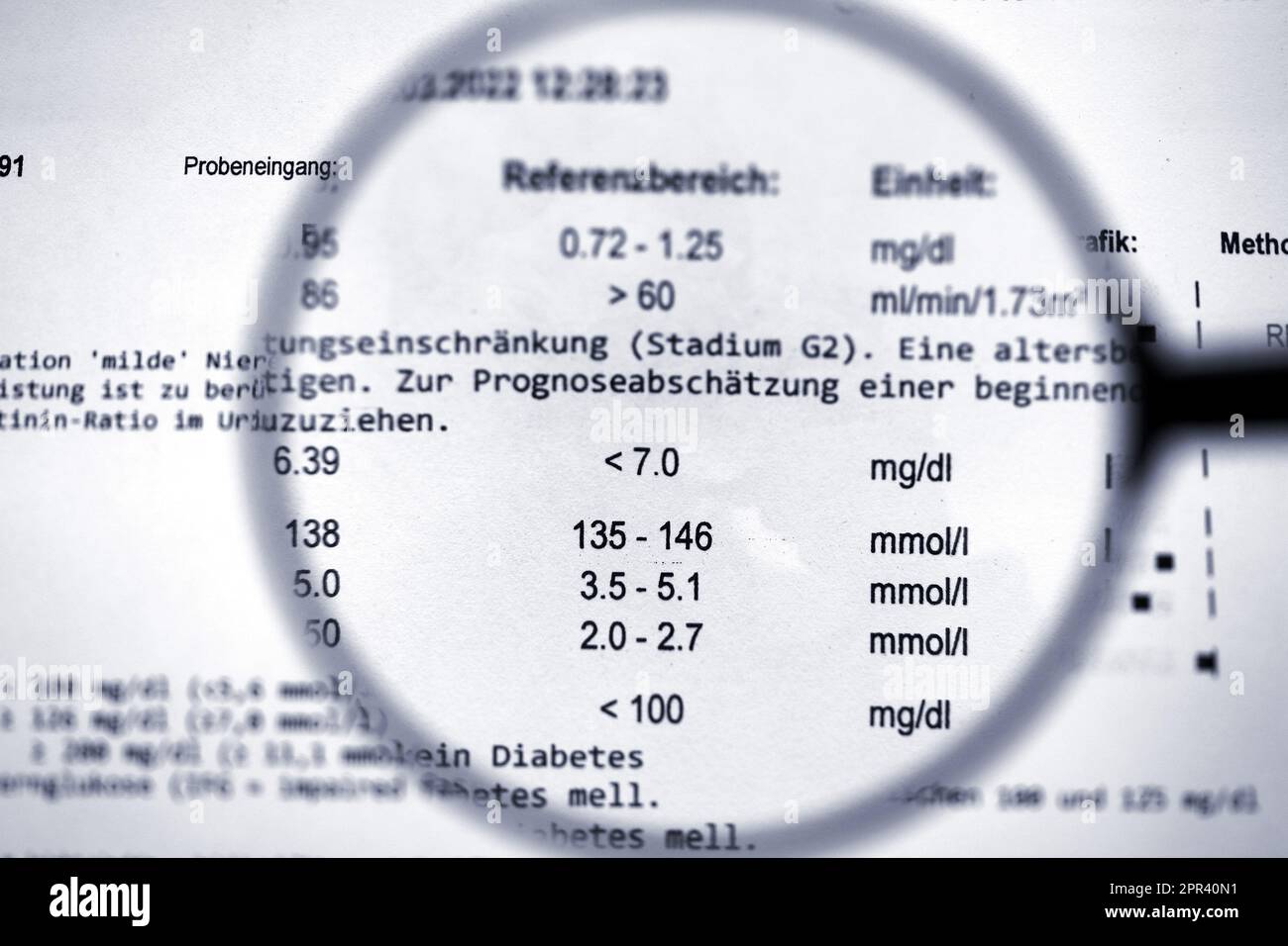 result of a blood test, haemogram, view with a loupe, reference area ...