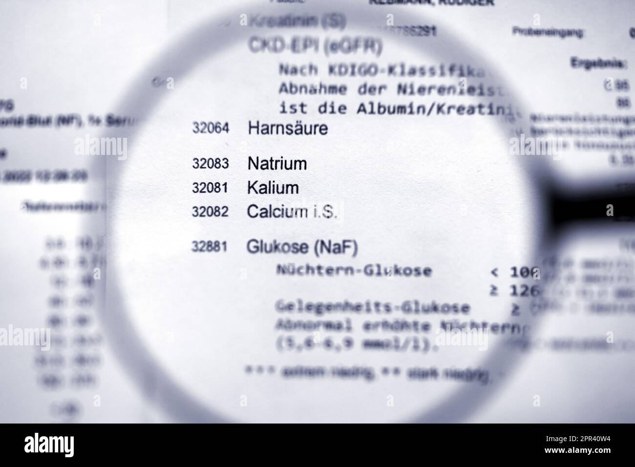 result of a blood test, haemogram, view with a loupe, reference area ...