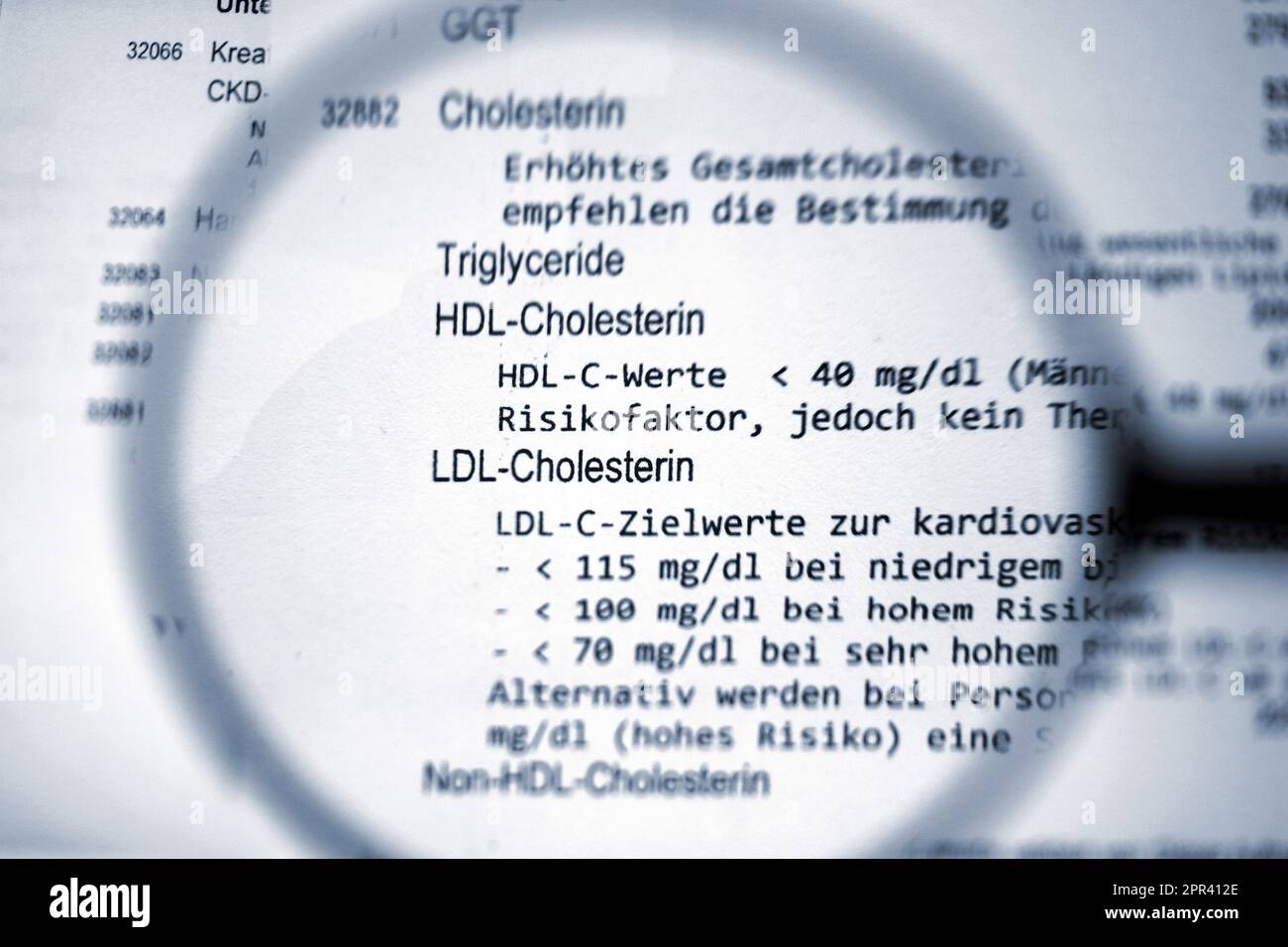 result of a blood test, haemogram, view with a loupe, cholesterol Stock ...
