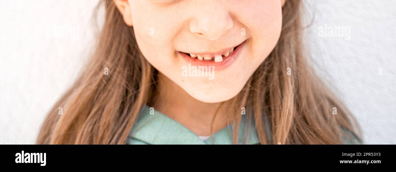 Charming smiling little girl kid with opened mouth shows staggering ...