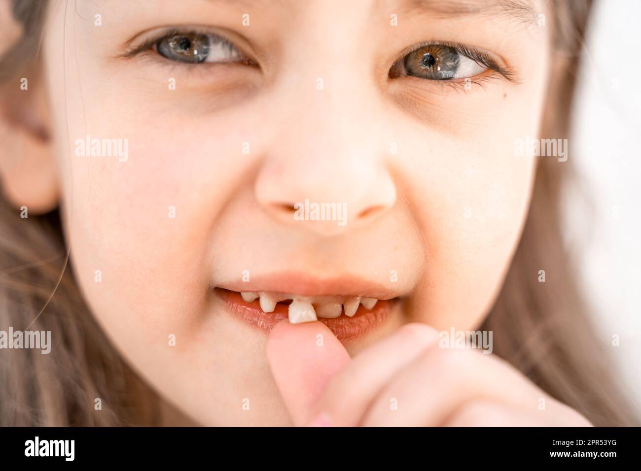Charming smiling little girl kid with opened mouth shows staggering ...