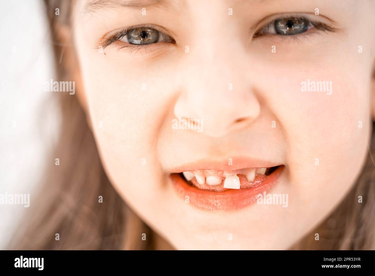 Charming smiling little girl kid with opened mouth shows staggering ...