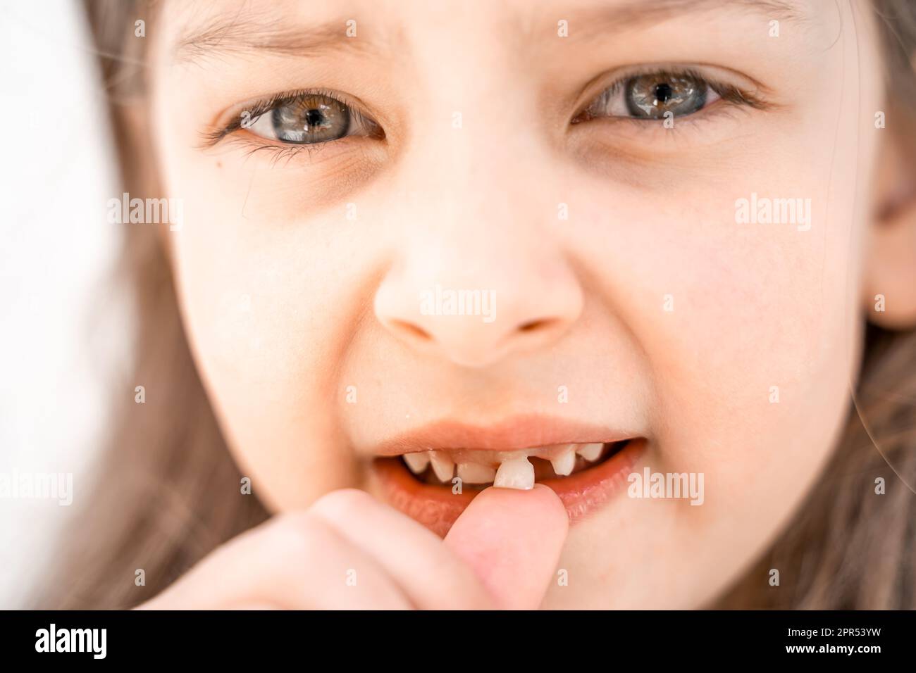 Charming smiling little girl kid with opened mouth shows staggering ...
