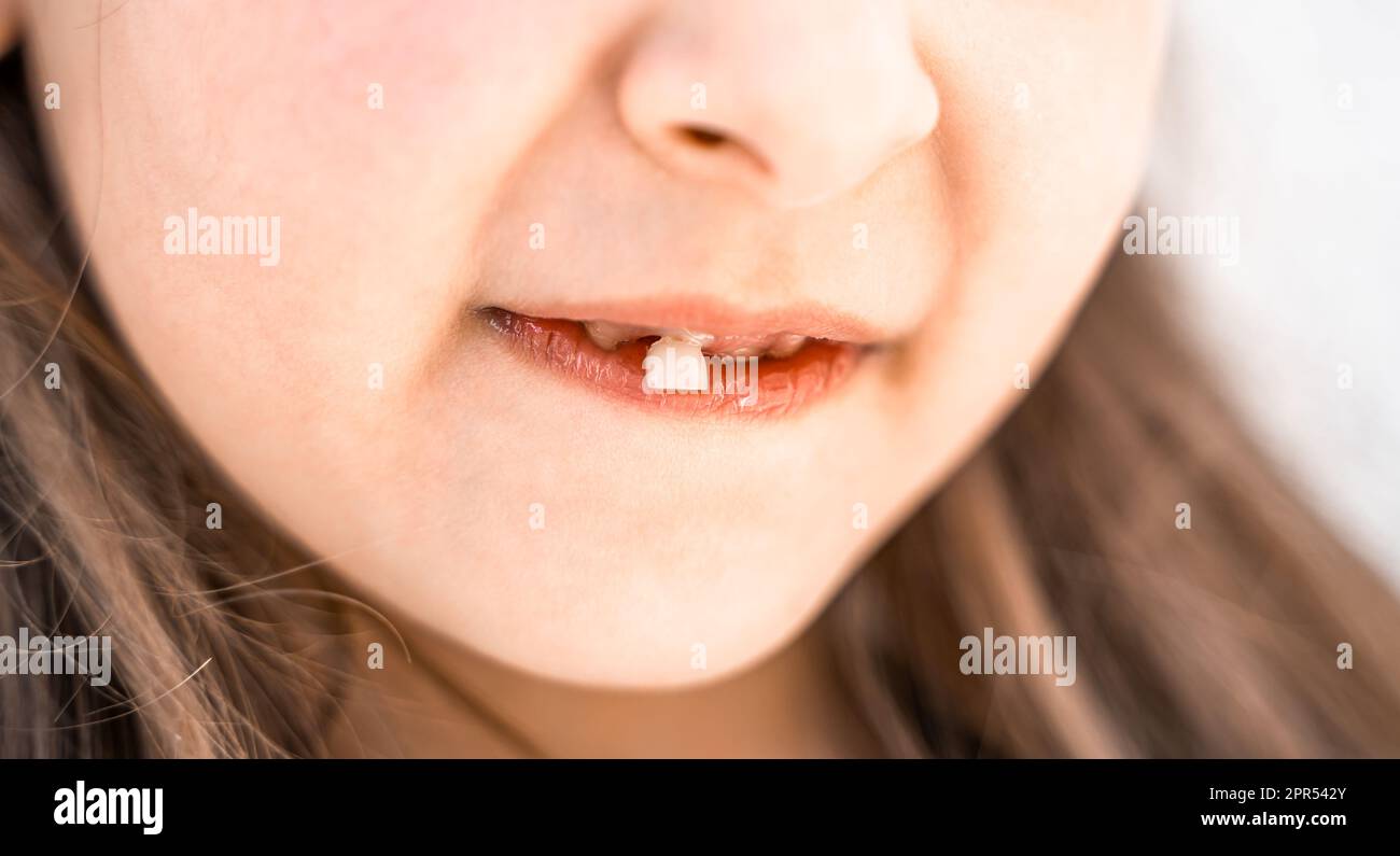 Charming smiling little girl kid with opened mouth shows staggering ...