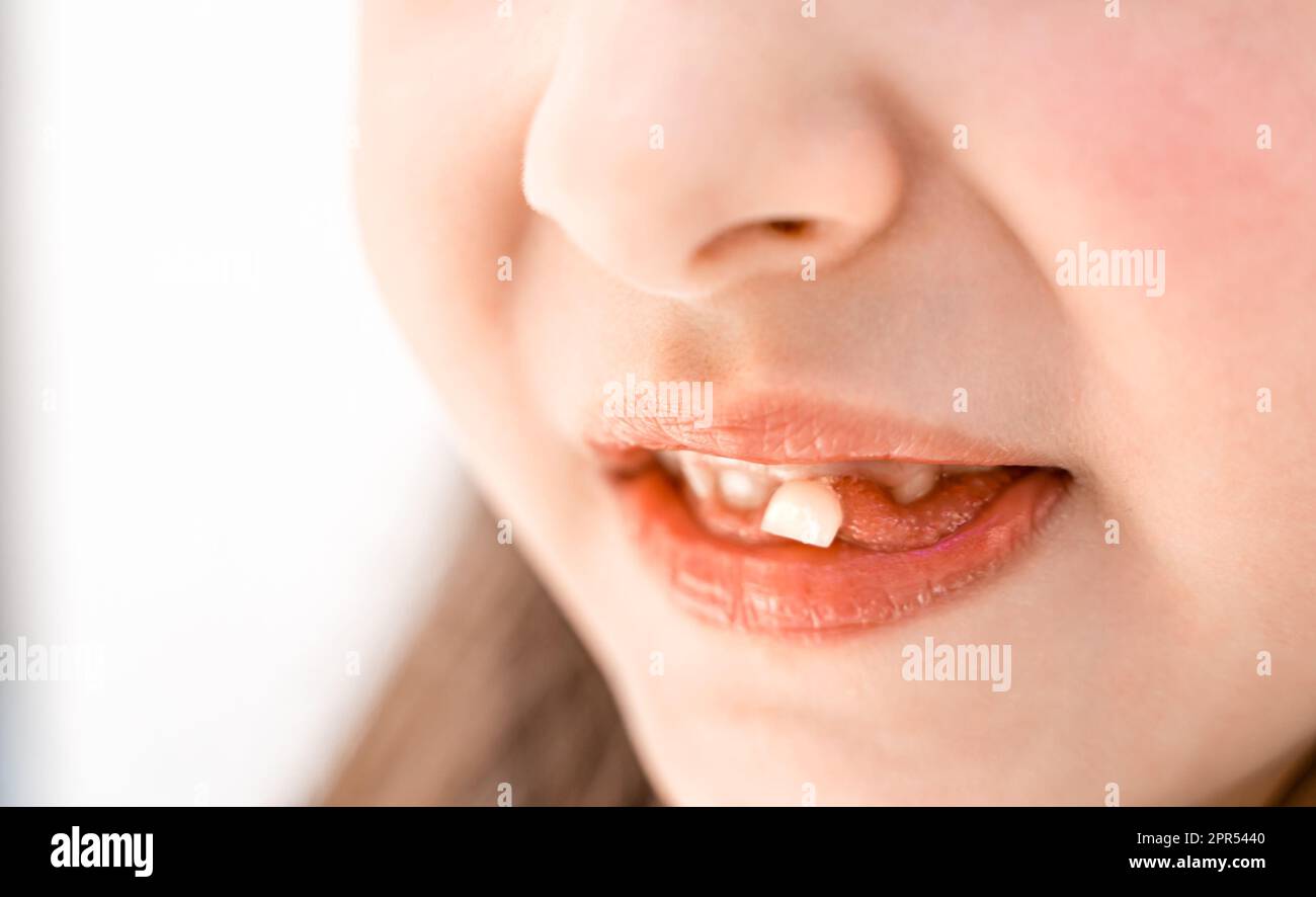 Charming smiling little girl kid with opened mouth shows staggering ...
