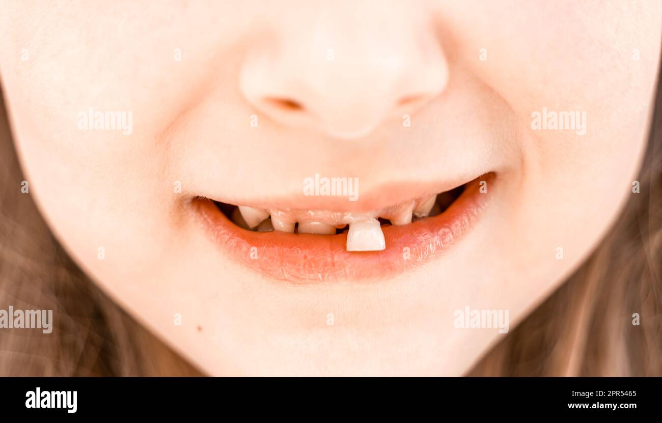 Charming smiling little girl kid with opened mouth shows staggering ...