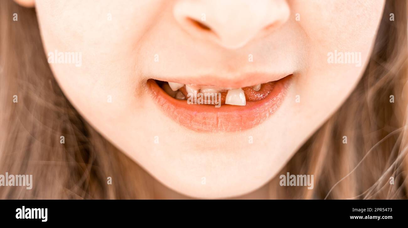 Charming smiling little girl kid with opened mouth shows staggering ...