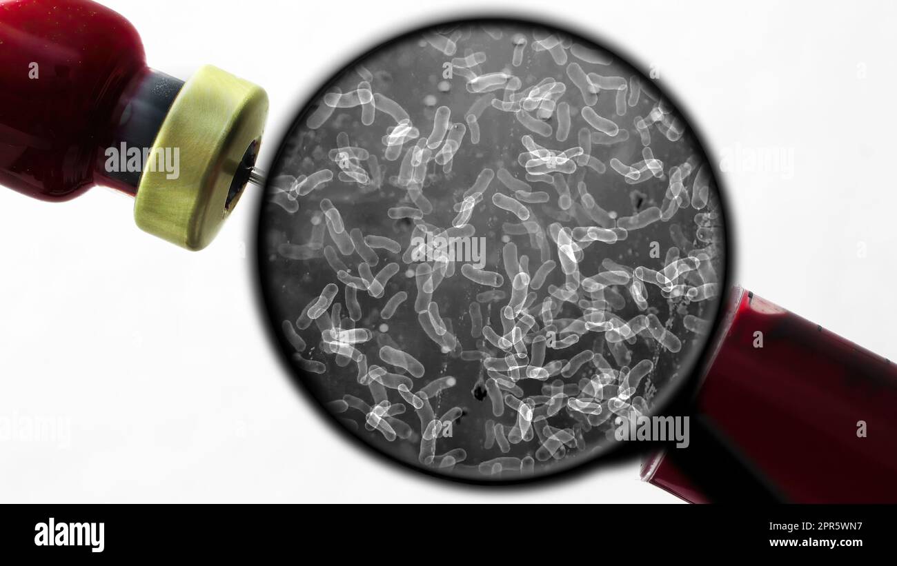 Searching for bacteria in blood Stock Photo - Alamy