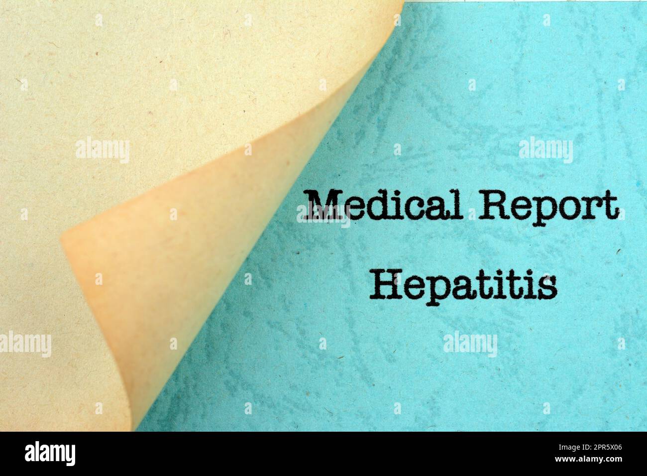 Hepatitis symptoms cirrhosis treatment hi-res stock photography and ...