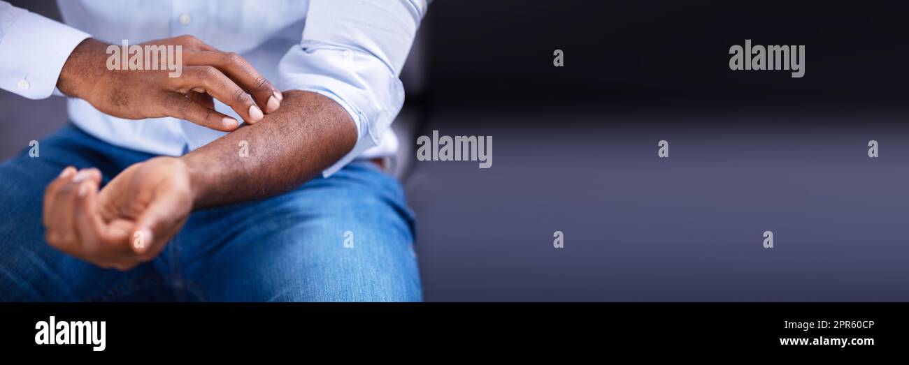 Man Scratching His Hand Stock Photo - Alamy