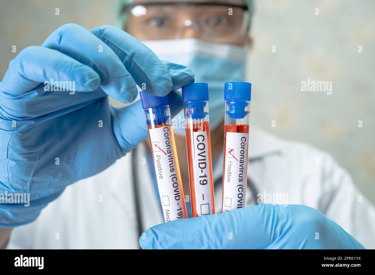 Positive blood infection sample in test tube for covid-19 coronavirus ...