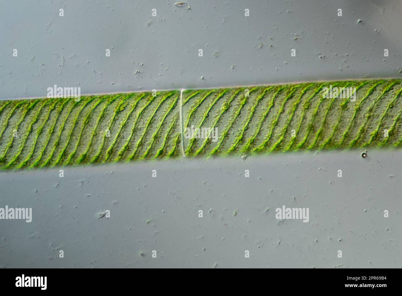 Spirogyra Pyrenoid
