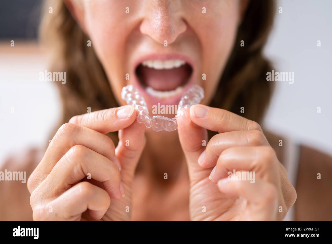 Clear Aligner Dental Night Guard Stock Photo - Alamy