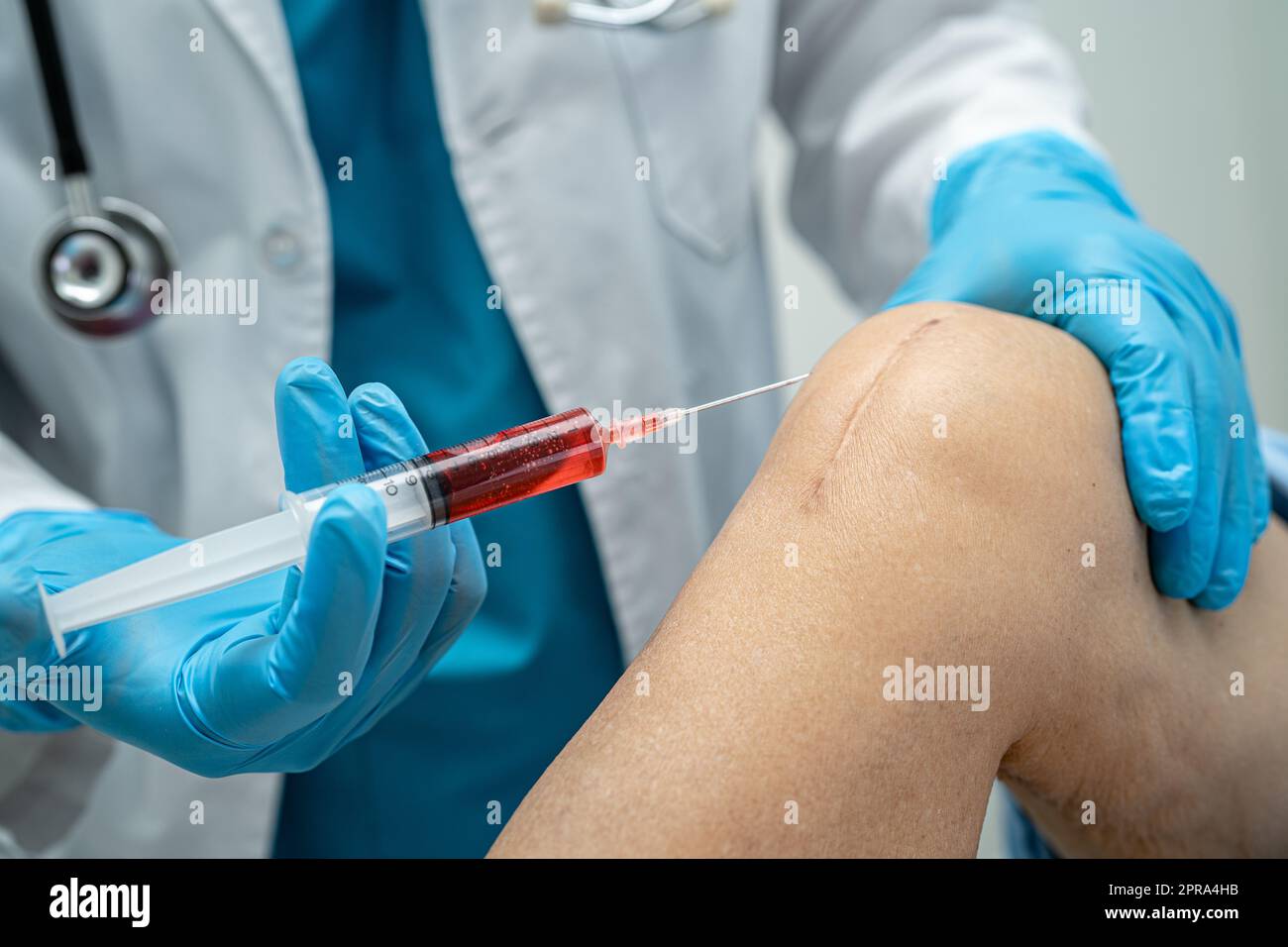 Asian doctor inject Hyaluronic acid platelet rich plasma into the knee ...