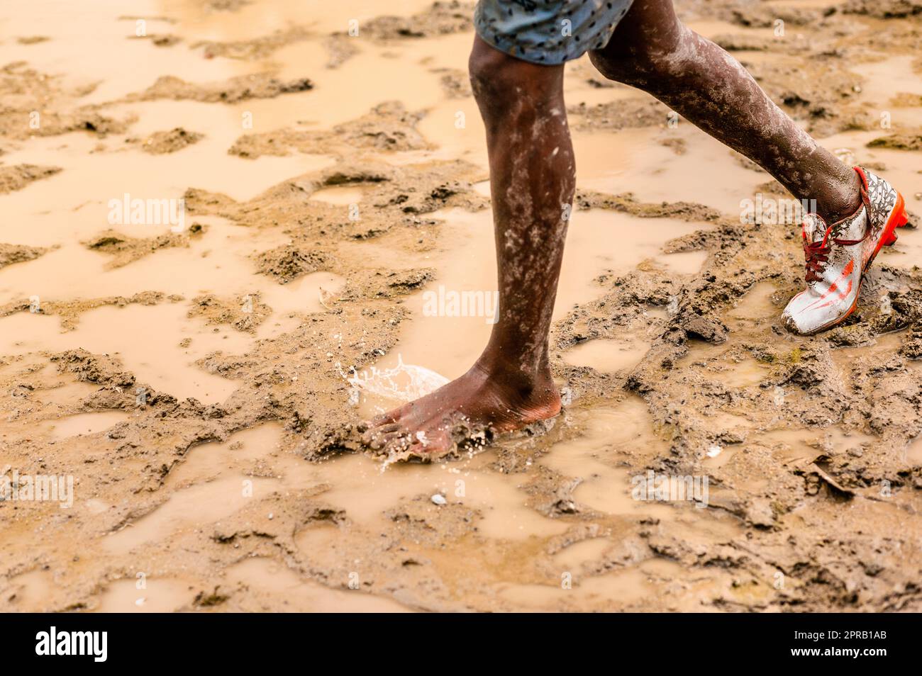 An Afro-Colombian football player, wearing only one football boot ...