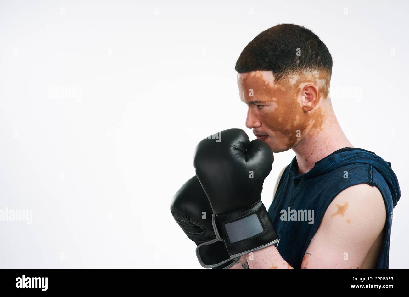 Male back skin hi-res stock photography and images - Alamy