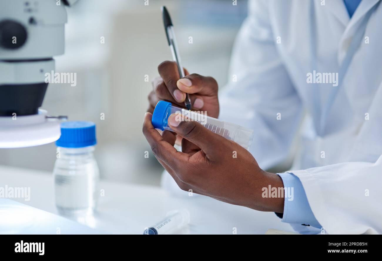 Lab test labels hi-res stock photography and images - Alamy