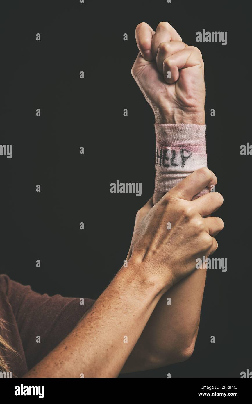 Arm Cuts Tumblr
