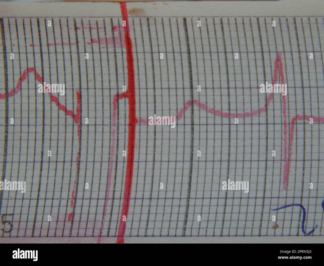 Scientific charts, cardiograms and mathematical calculations Stock ...