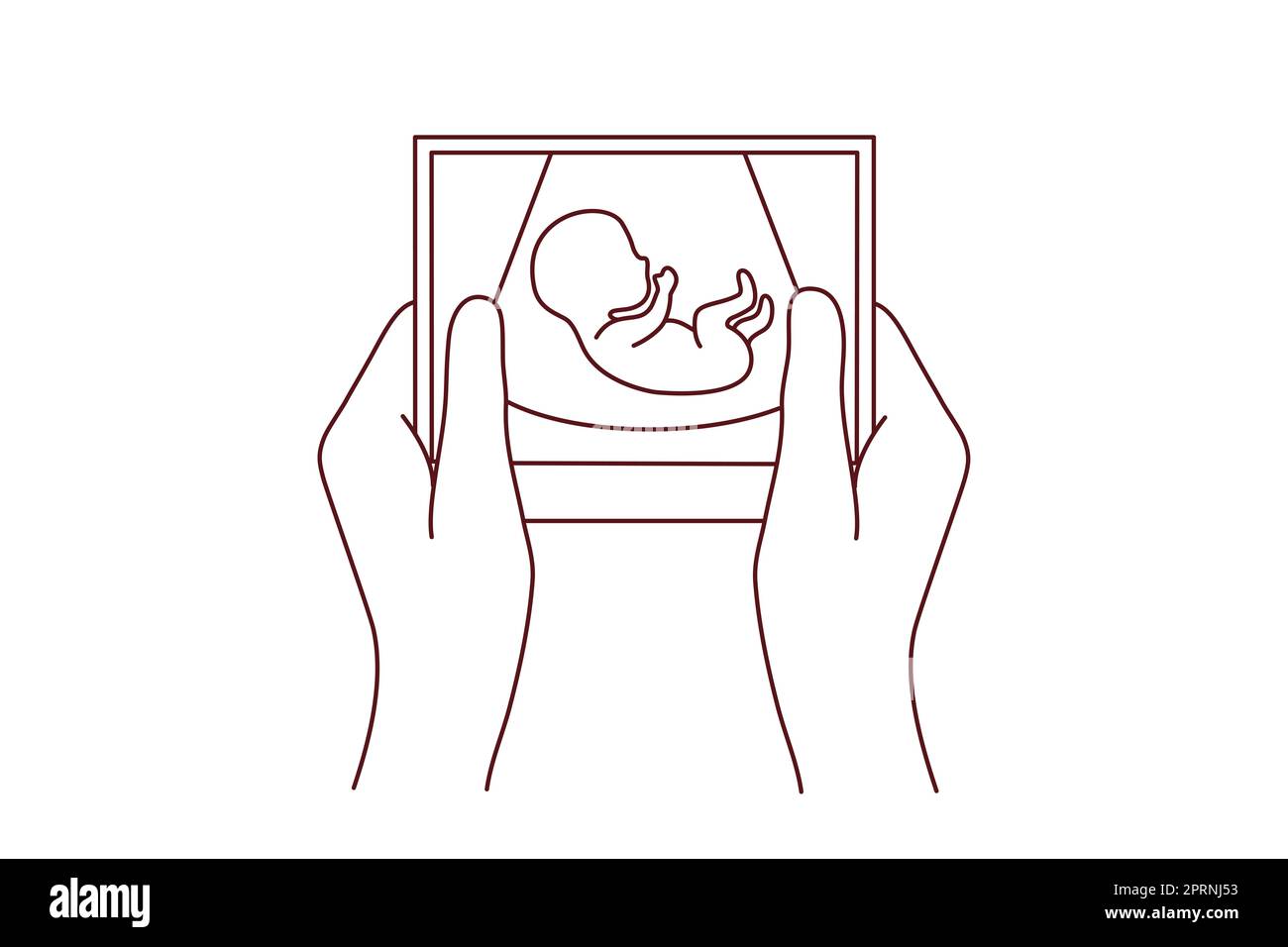 Ultrasonic picture Cut Out Stock Images & Pictures - Alamy