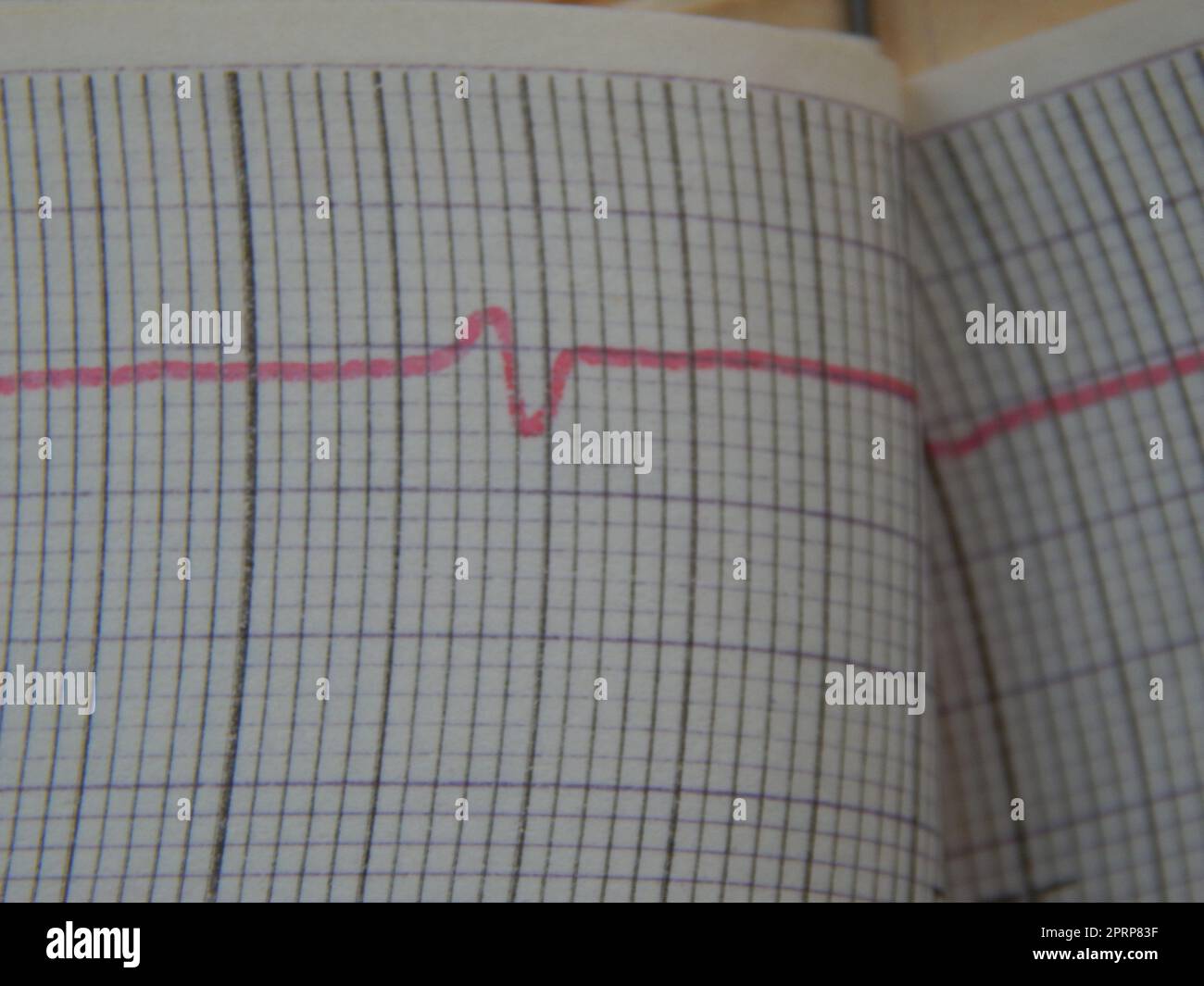 Scientific charts, cardiograms and mathematical calculations Stock ...