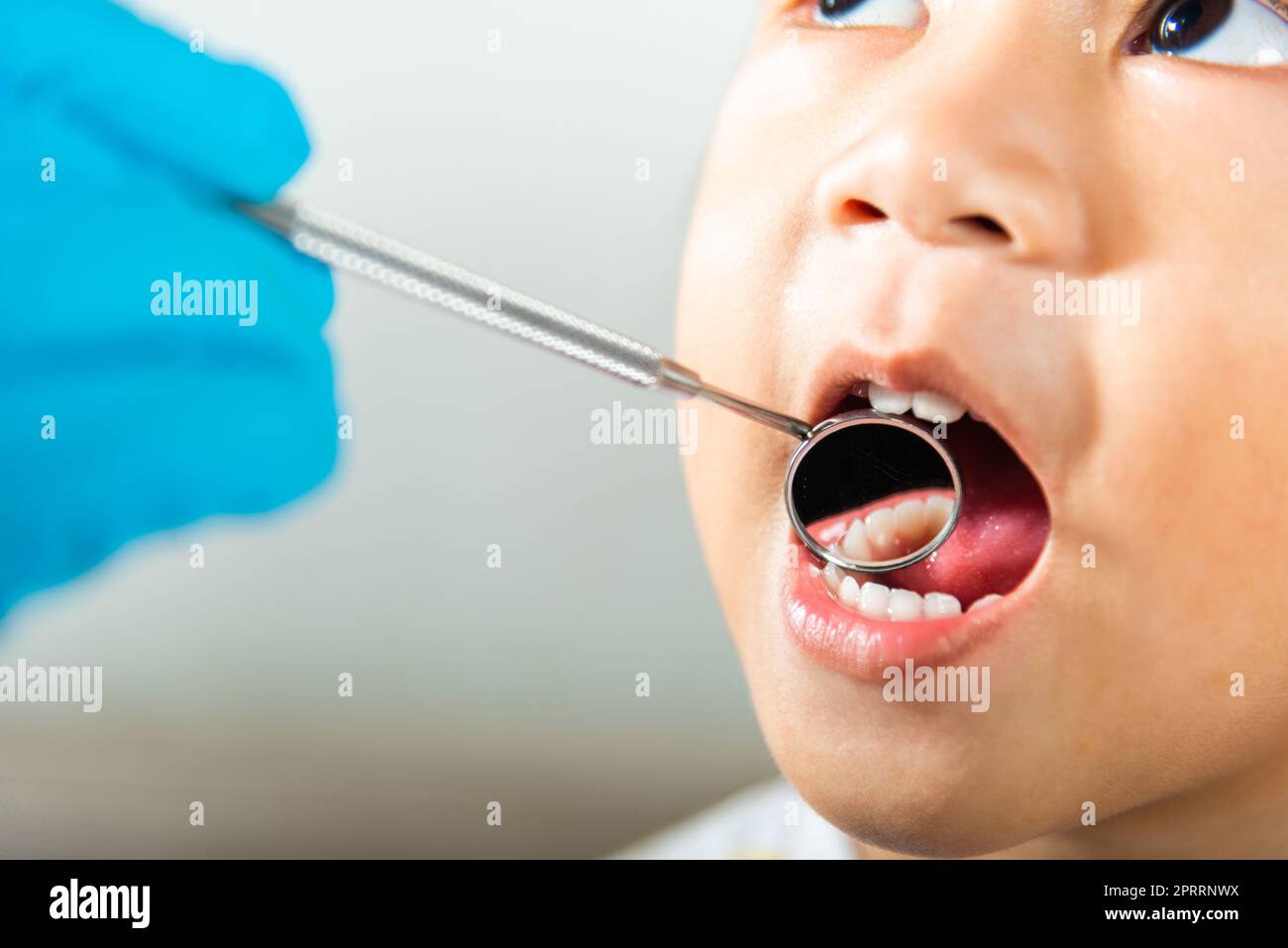 Doctor examines oral cavity of little child uses mouth mirror to ...