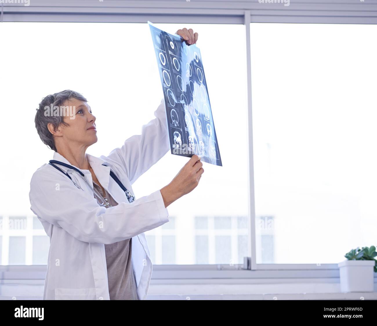 Abnormalities hi-res stock photography and images - Alamy