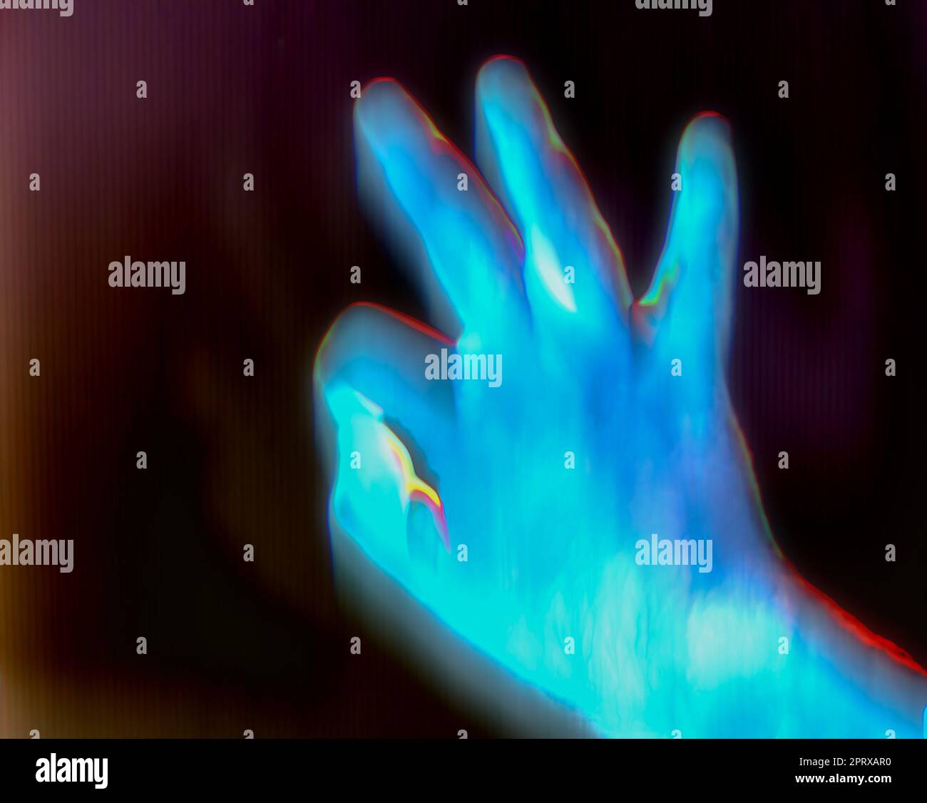 Human wrist anatomy xray view hi-res stock photography and images - Alamy