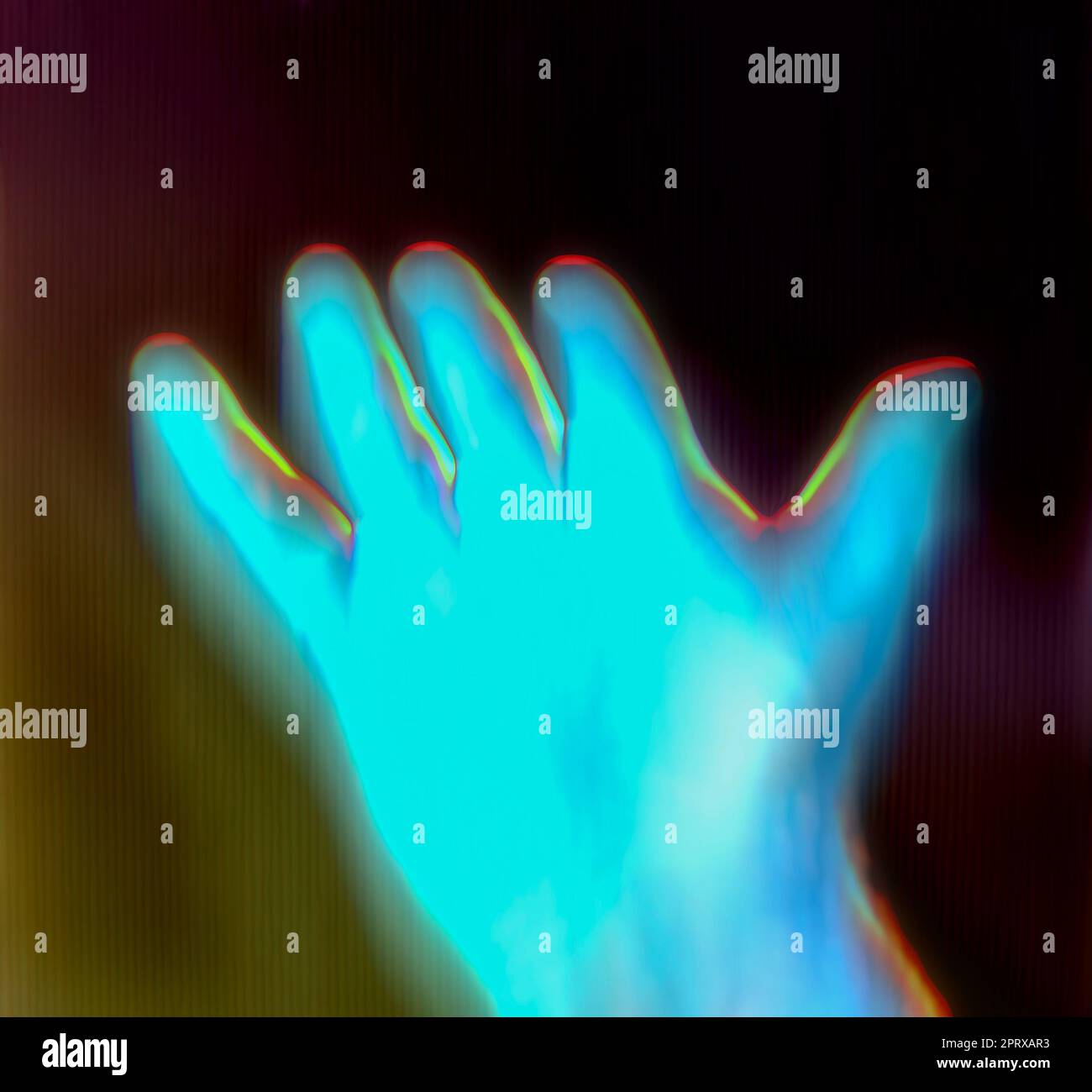 Human wrist anatomy xray view hi-res stock photography and images - Alamy