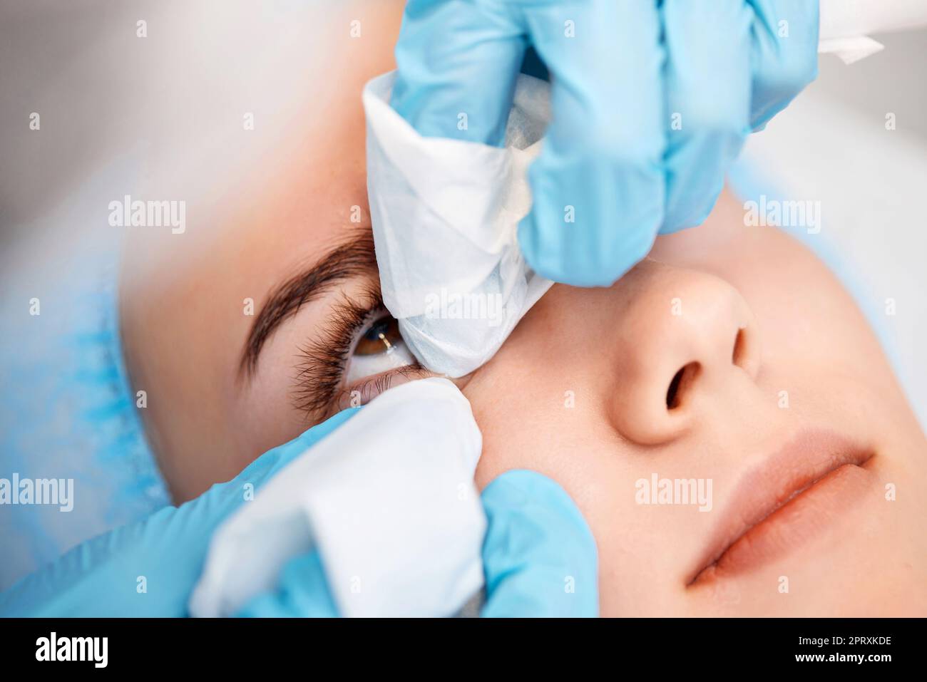 Lipoma hi-res stock photography and images - Alamy