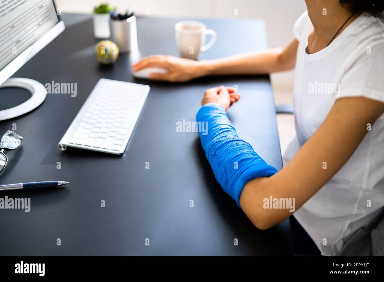 Injured Worker Compensation. Broken Arm African Woman On Computer Stock ...