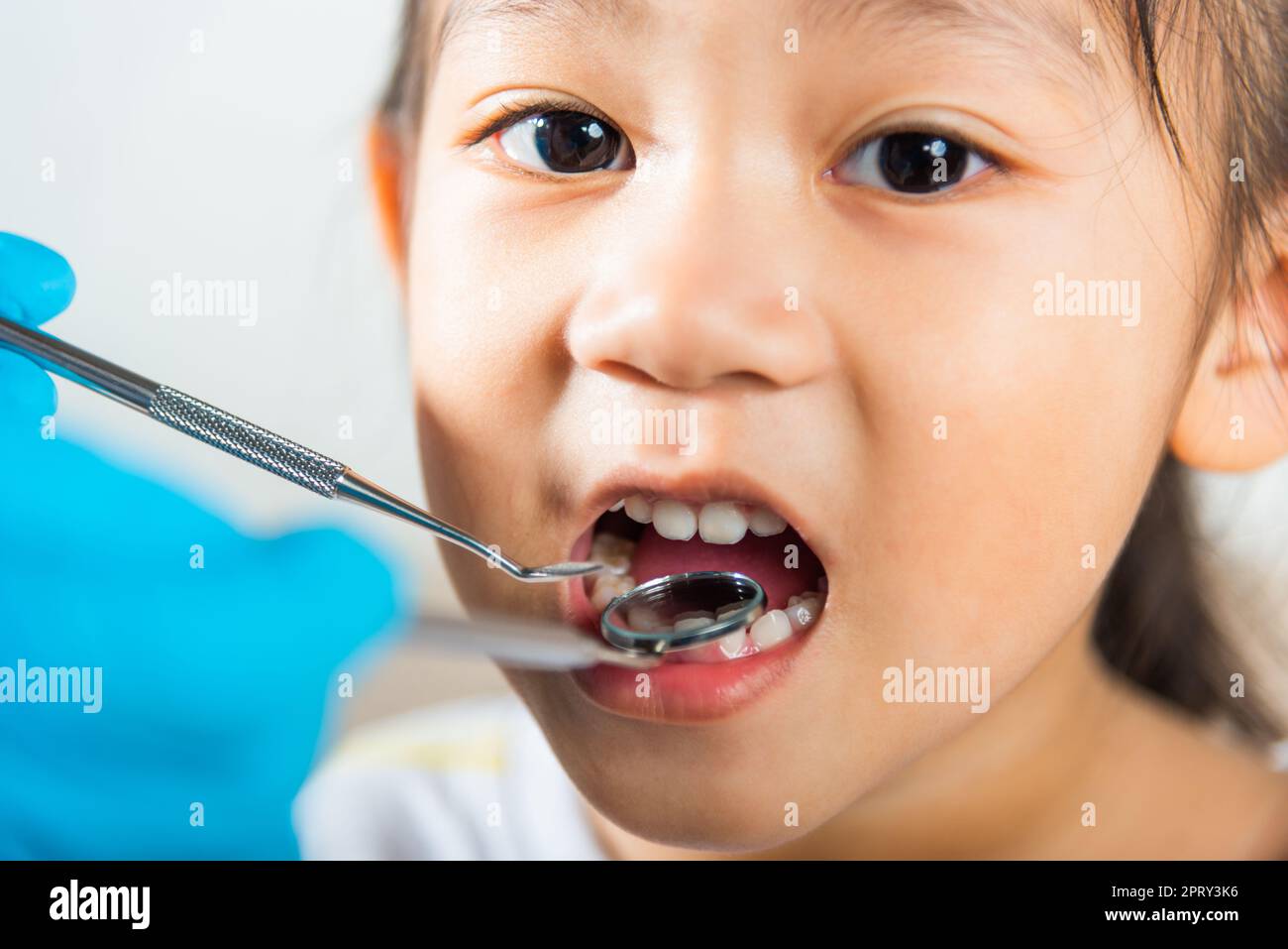 Dental kid health examination. Asian dentist making examination procedure for cute little girl ...