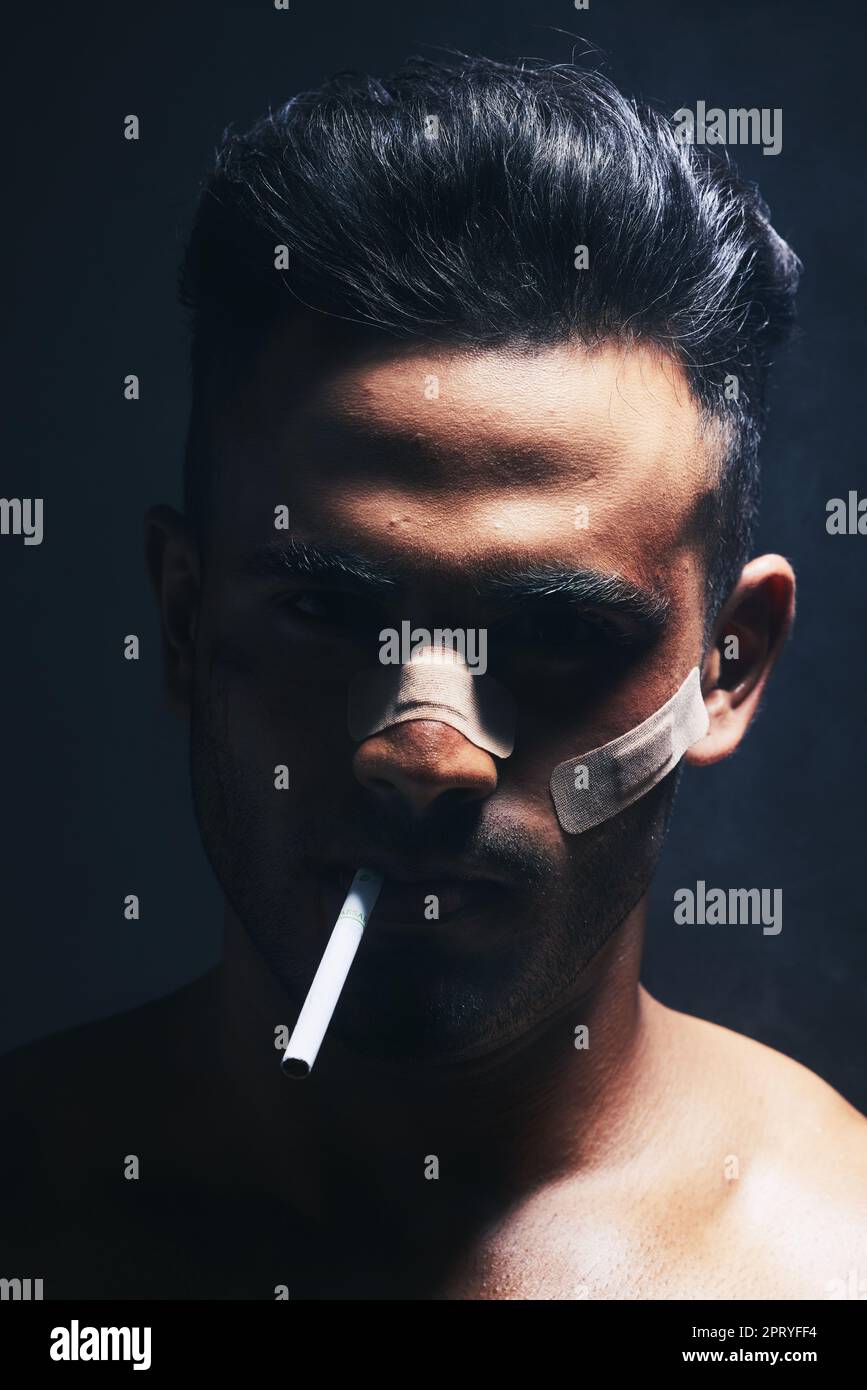 Blood in face after accident hi-res stock photography and images - Alamy