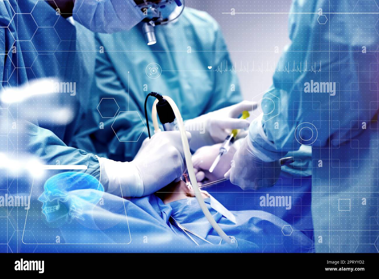 Team of professional doctors performing operation in surgery room and ...