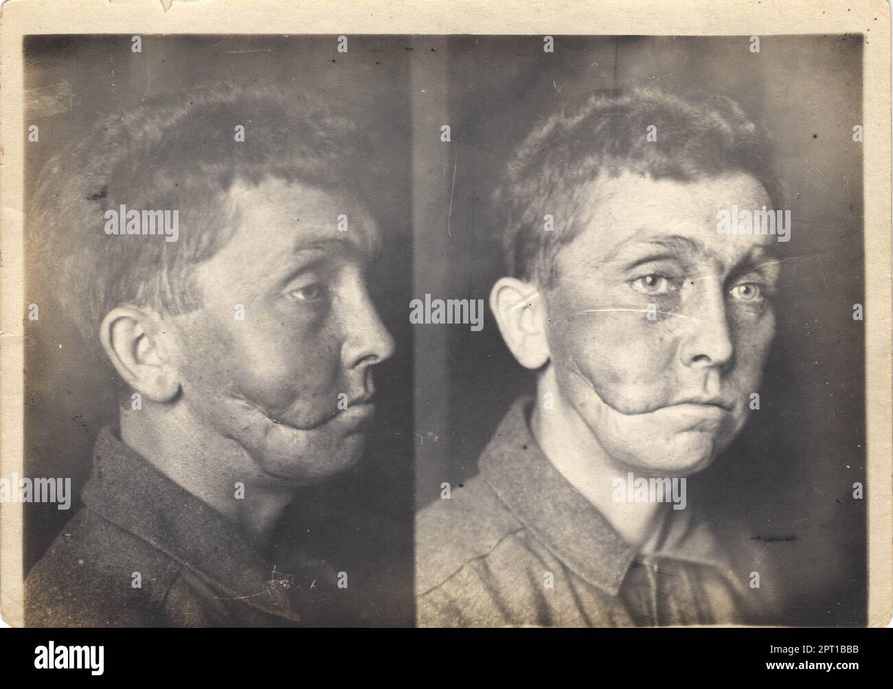 Injured and Wounded Stock Photo - Alamy