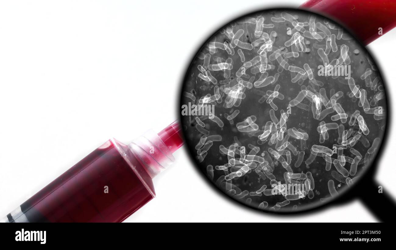 Searching for bacteria in blood Stock Photo - Alamy