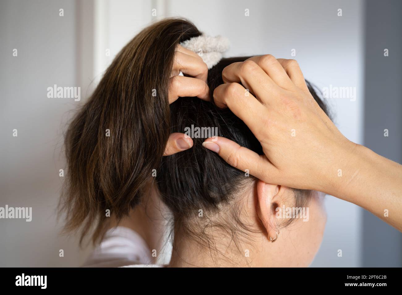 Young Woman Scratching Her Itchy Head Scalp Stock Photo - Alamy