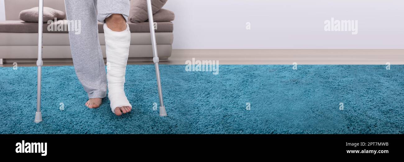 Broken Leg Man With Crutches After Accident Stock Photo - Alamy