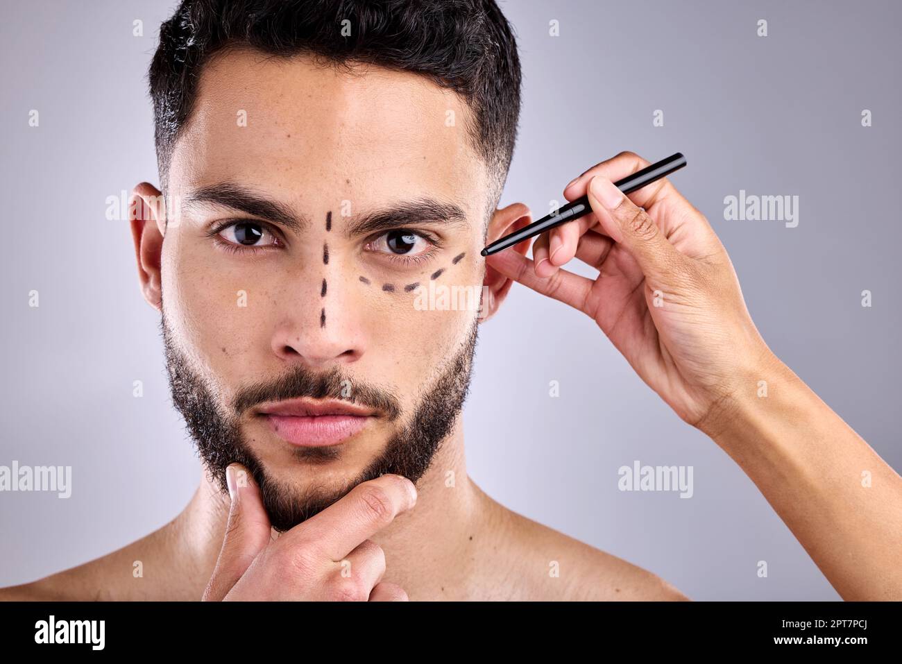 I want to look more like you. a man with cosmetic surgery markings on ...