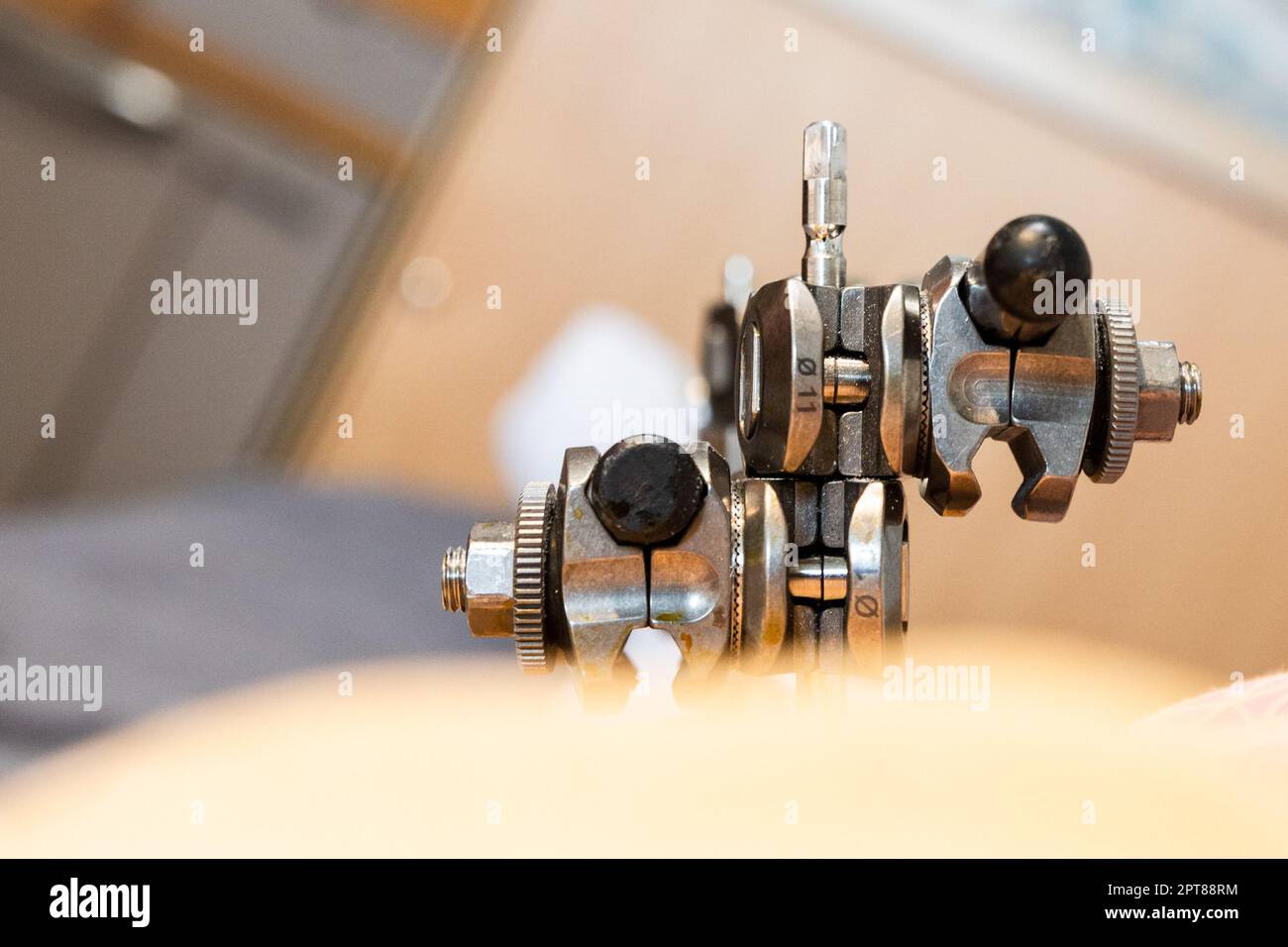 pov view of external fixation device on pelvic close up in patient with ...
