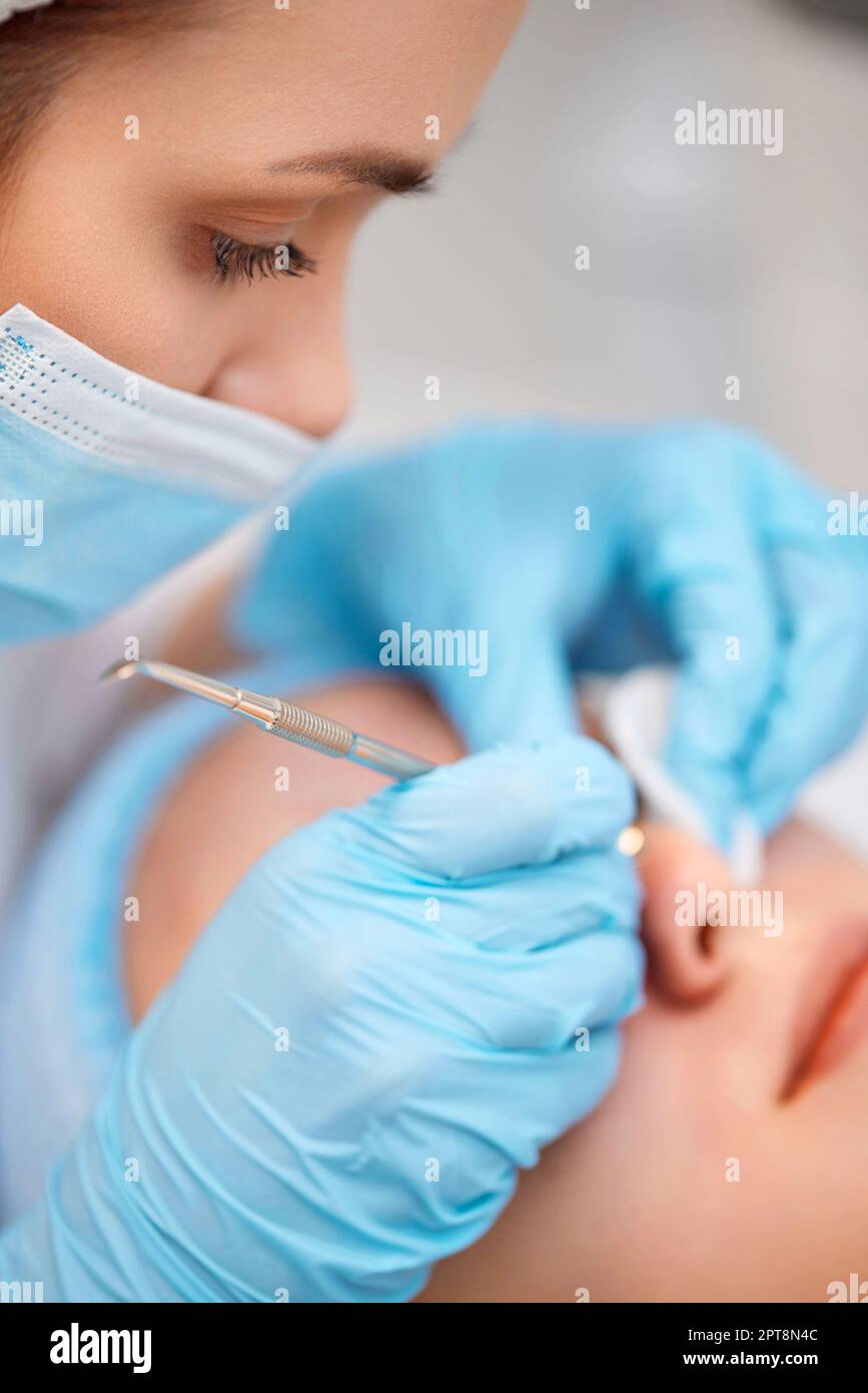 young woman during a mechanical face cleansing procedure at beauty ...