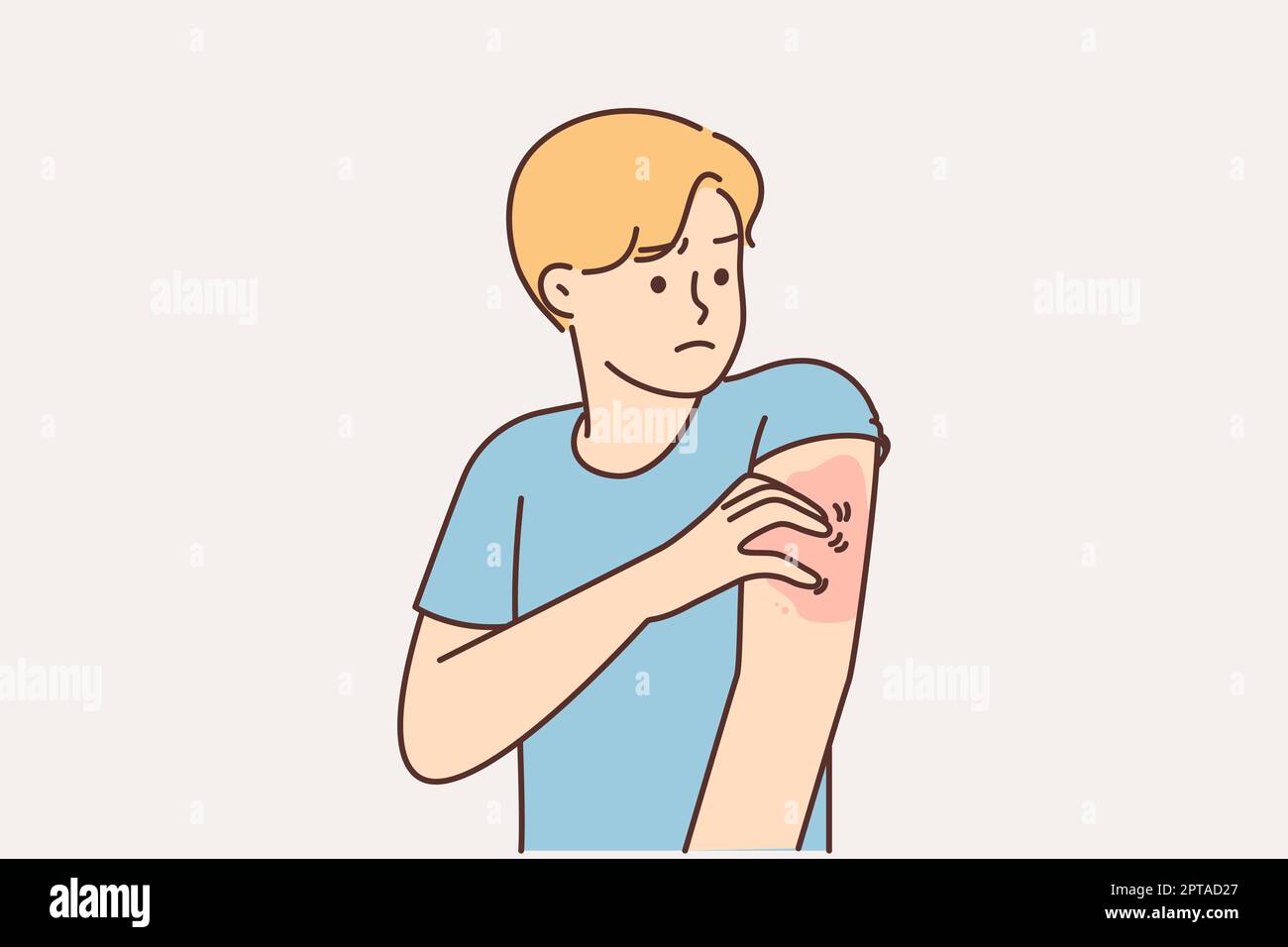 Unhealthy man scratching arm suffer from monkey pox. Unwell guy itch ...