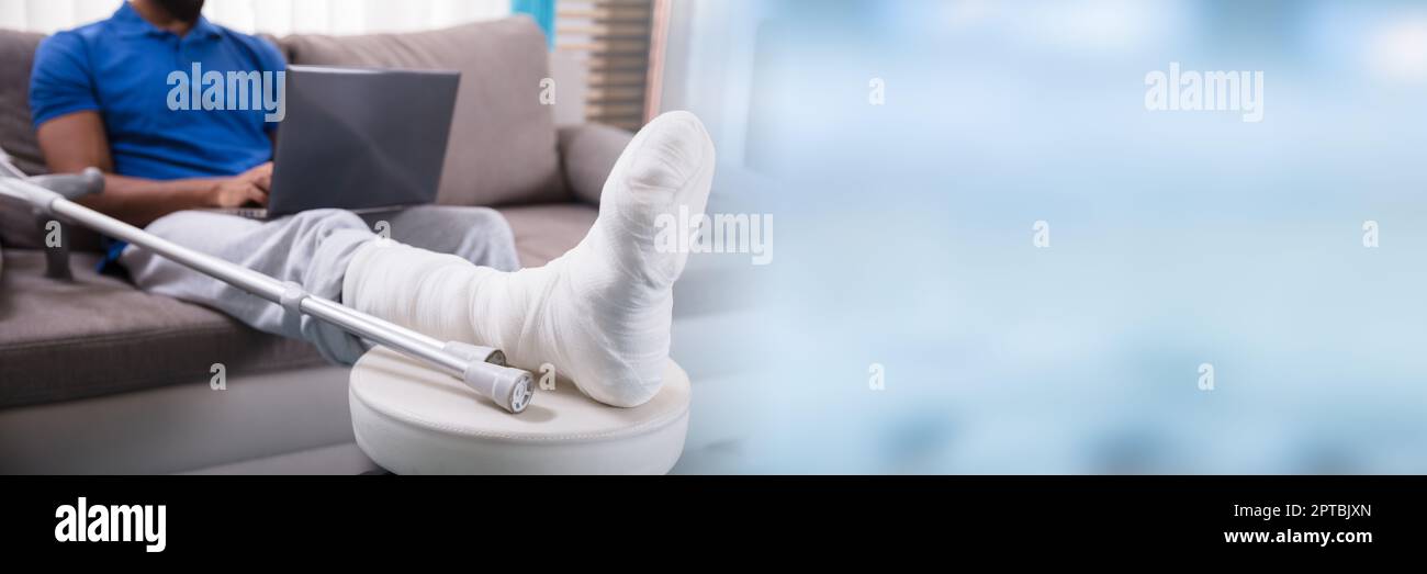 Injured Man Broken Leg Cast. African American Home Accident Stock Photo ...