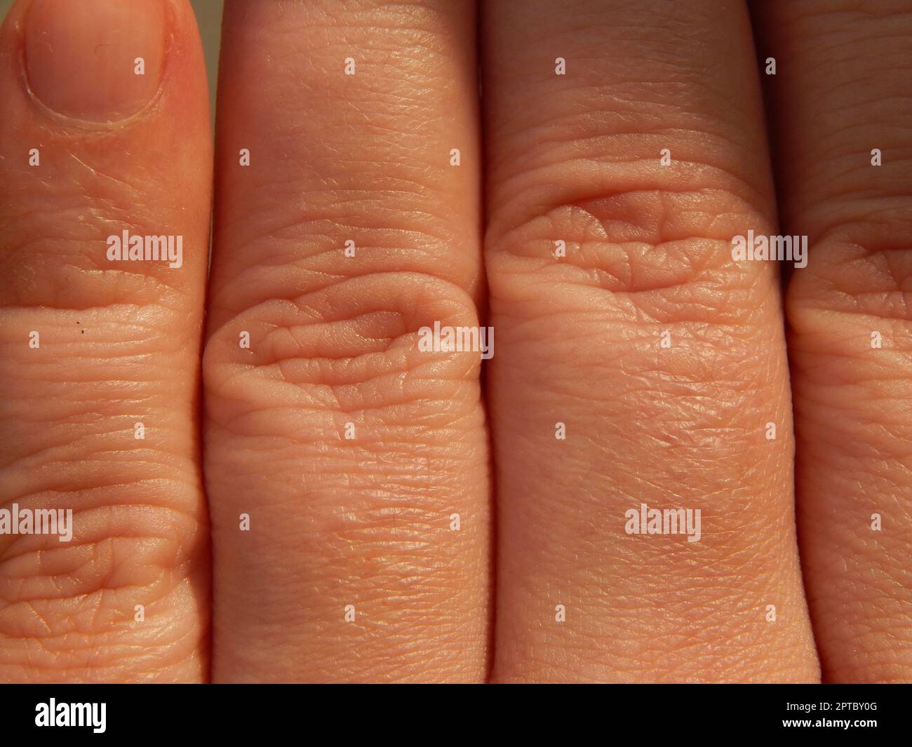 Human skin texture in various parts of the body Stock Photo - Alamy