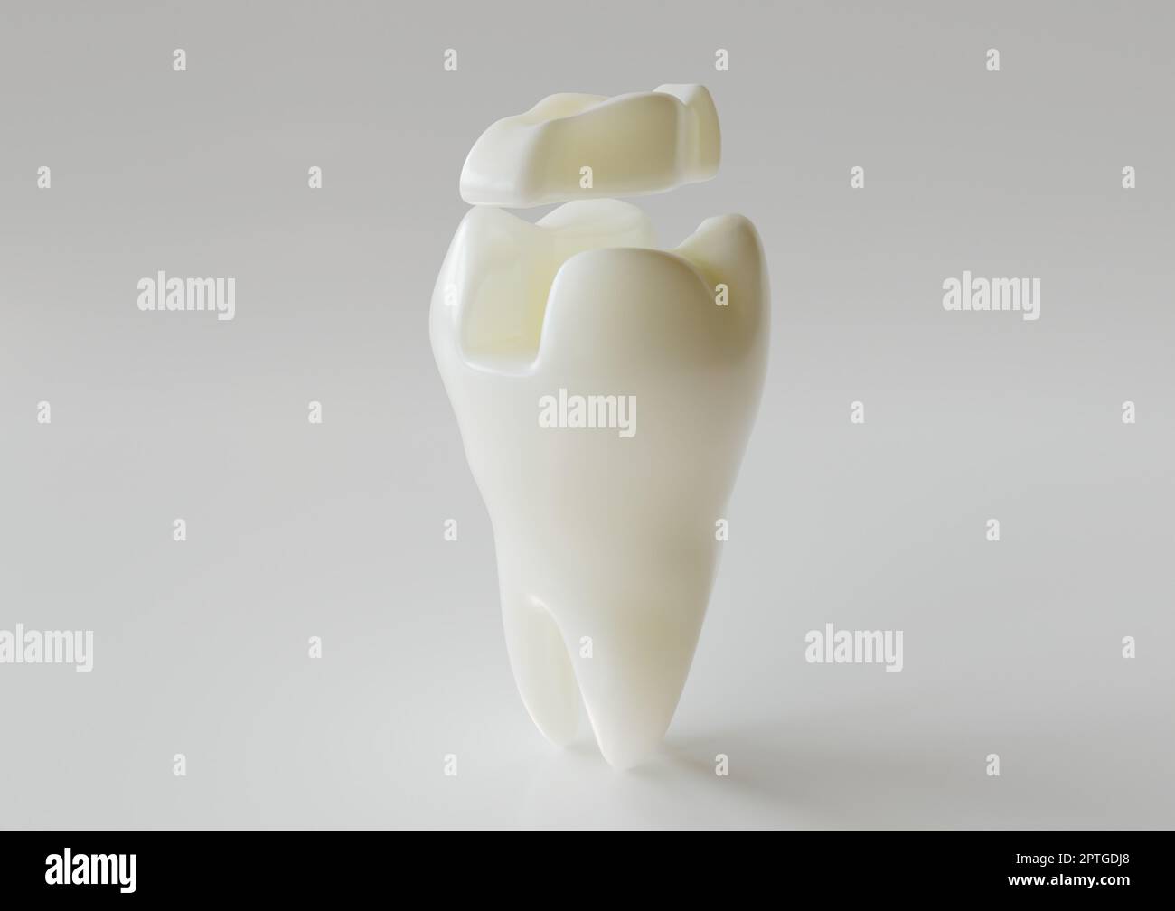 Ceramic Inlay crown over a totth - 3D Rendering Stock Photo - Alamy