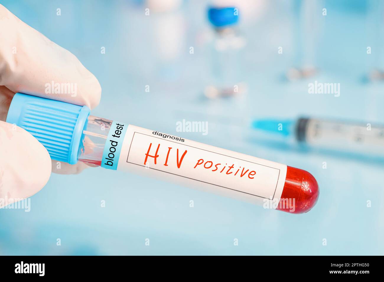 Diagnostician holding in hand a positive HIV test on a blue laboratory ...