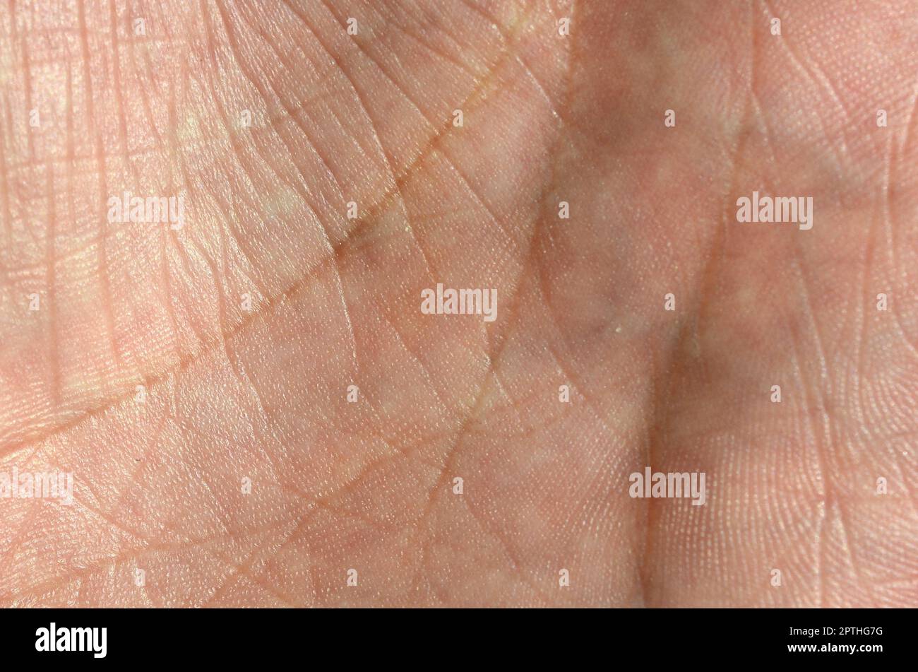 Female surface anatomy hi-res stock photography and images - Alamy