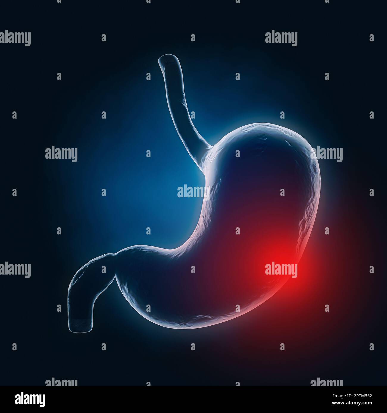 Human Stomach Anatomy Internal Organ X-Ray View with Red Zone of Pain ...