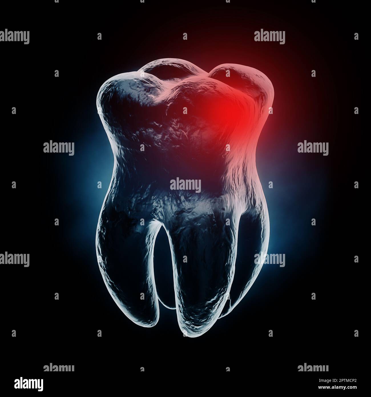 Medically Accurate Aching Tooth X-Ray View with Red Zone of Pain on a ...