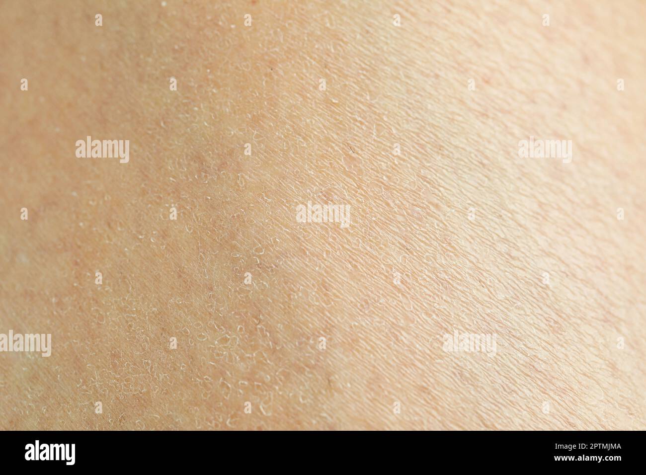 Texture of clean human skin, closeup view Stock Photo - Alamy